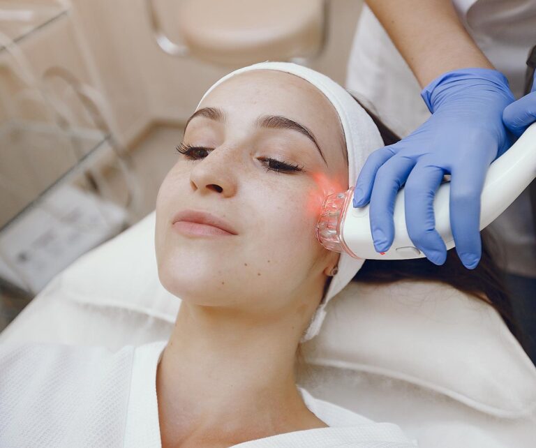 Laser IPL Photofacial - Allure Medical Aesthetics